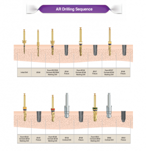 ایمپلنت Biotem کره – دنتال اکسپرس